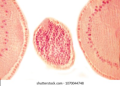 Human Worm Under Microscope Stock Photo 1070044748 | Shutterstock