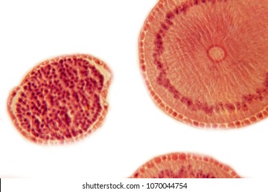 Human Worm Under Microscope Stock Photo 1070044754 | Shutterstock