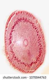 Human Worm Under Microscope Stock Photo 1070044763 | Shutterstock