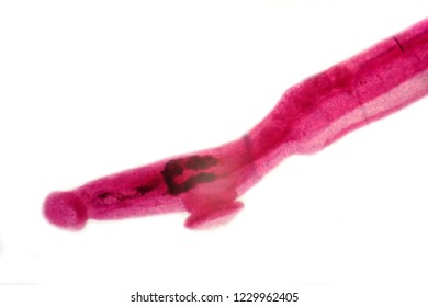 Foto Stok Human Worm Under Microscope (Edit Sekarang) 1229962405
