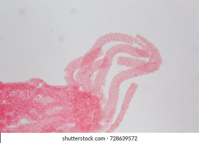 Purulent Pimple On Human Skin Stock Photo (Edit Now) 1303125025