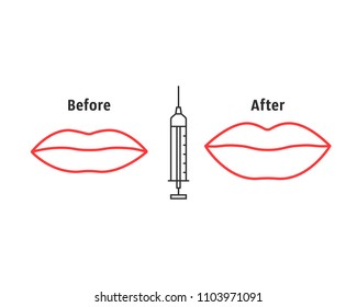 Filler Logo Vectors Free Download