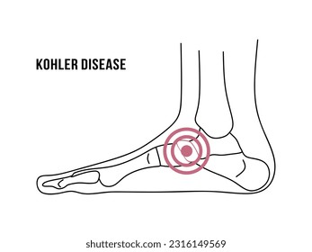 Kohler Logo Vector