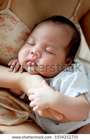 TRANSIENT-NEONATAL-PUSTULAR-MELANOSIS Stock Photos and Images - Avopix.com