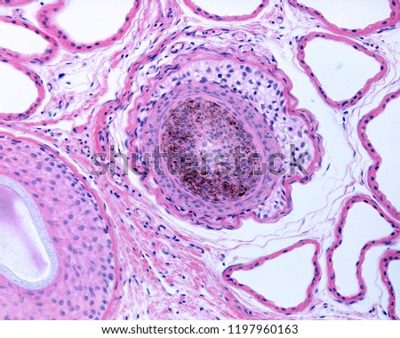 INTERNAL-EPITHELIAL-ROOT-SHEATH Stock Photos and Images - Avopix.com