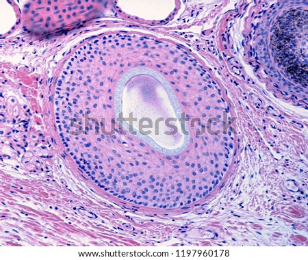 INTERNAL-ROOT-SHEATH Stock Photos and Images - Avopix.com
