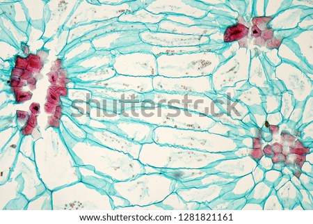 SCLEREID Stock Photos and Images - Avopix.com
