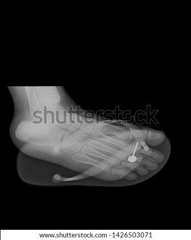 TREATMENTRADIOGRAPHY Stock Photos and Images - Avopix.com