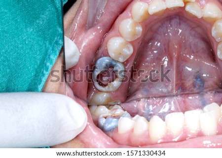 PULP-POLYP Stock Photos and Images - Avopix.com
