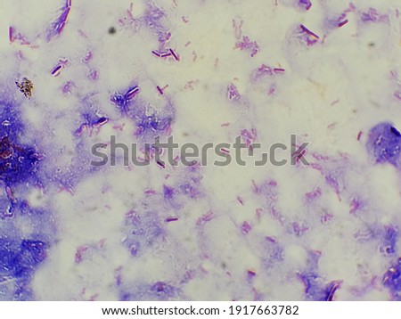 Bacillus Subtilis Under Microscope