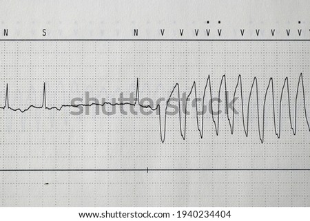 ABERRANT-CONDUCTION Stock Photos and Images - Avopix.com
