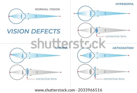 VISION-DEFECT Stock Vector Images - Avopix.com