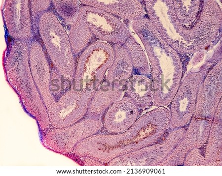 RABBIT-TESTICLE Stock Photos and Images - Avopix.com