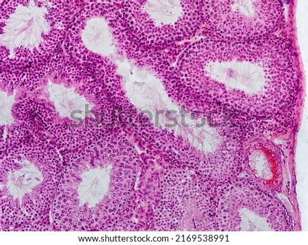 RABBIT-TESTICLE Stock Photos and Images - Avopix.com