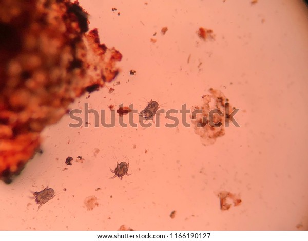 「Image Cat Ear Mite Microscope」の写真素材（今すぐ編集） 1166190127