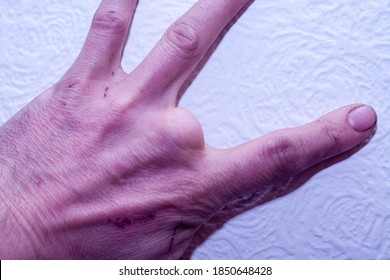 Hand Pinch Skin Old Woman Flexible Stock Photo 1191530269 | Shutterstock