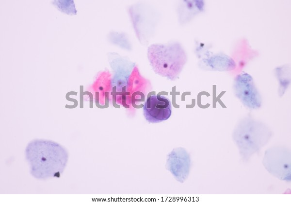 Image Microscopic Herpes Simplex Virus Infection Stock Photo (Edit Now ...