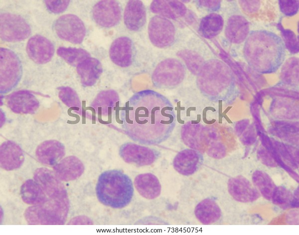 Immunoblast Stock Photo (Edit Now) 738450754