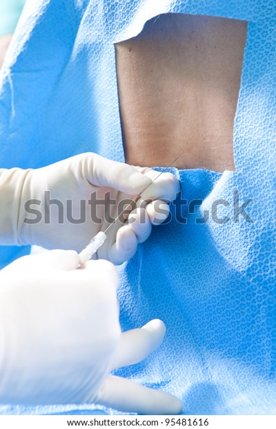 Injection Back Stock Photo 95481616 | Shutterstock