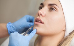 Subcutaneous injection lips containing background, medical, and woman ...