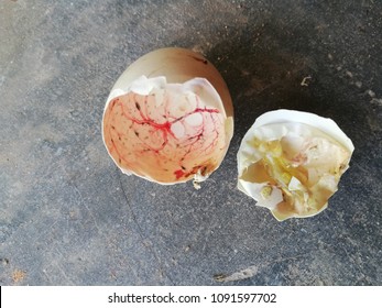 54 Broken blood vessel in brain Images, Stock Photos & Vectors ...