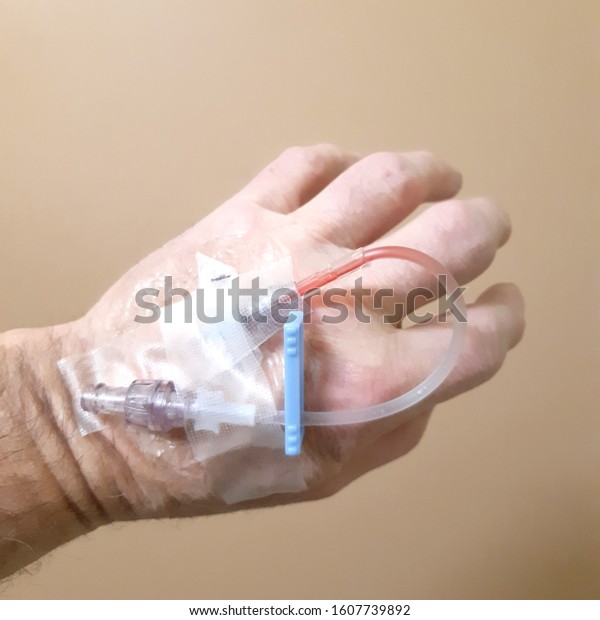 Iv Medication Through Peripheral Venous Catheter Stock Photo 1607739892 ...