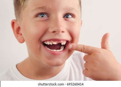 Kid Showing Missing Teeth Foto de stock 695260414 | Shutterstock