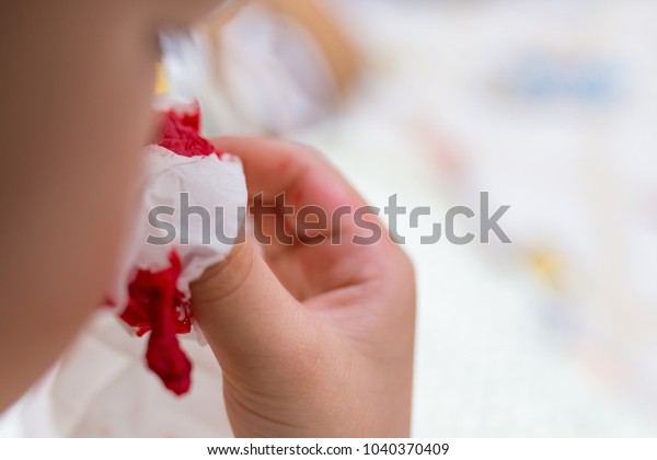 Kid Using Tissue Stop Nose Bleeding Stock Photo 1040370409 | Shutterstock