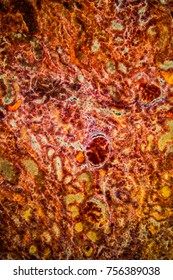 Kidney Bleeding Under Microscope Stock Photo (Edit Now) 756389038