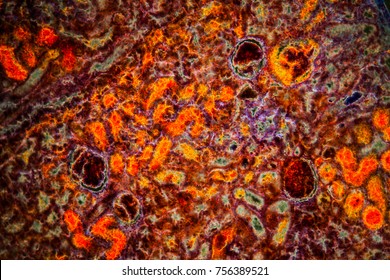 Kidney Bleeding Under Microscope Stock Photo 756389521 | Shutterstock