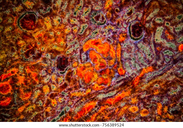 Kidney Bleeding Under Microscope Stock Photo 756389524 | Shutterstock