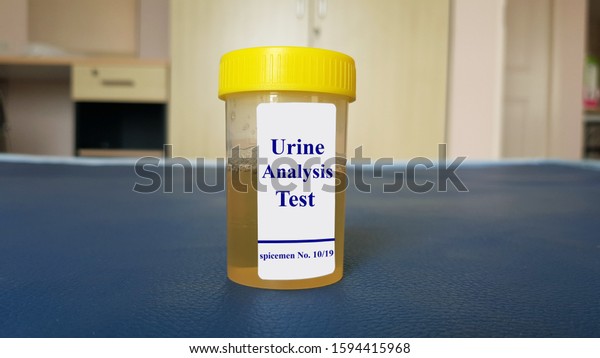 Laboratory Sample Urine Urine Analysis Test Stock Photo (Edit Now ...