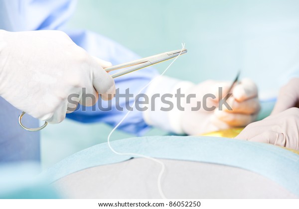 Laminectomyback Operation Stock Photo (Edit Now) 86052250