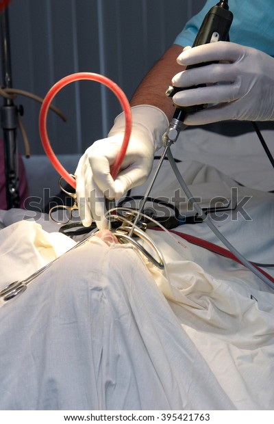 Laparoscopy Stock Photo (Edit Now) 395421763