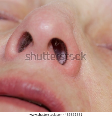 Free polyp Stock Photos - Stockvault.net
