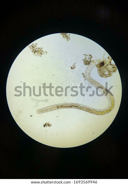 Larva Under Microscope Stock Photo 1693569946 | Shutterstock