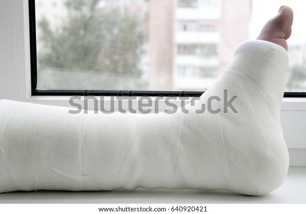 Leg Plaster Stock Photo 640920421 | Shutterstock