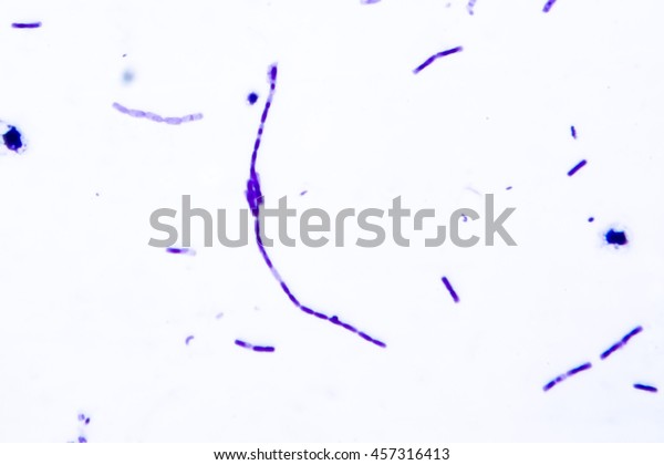 Light Micrograph Grampositive Bacteria Bacillus Anthracis Stock Photo ...