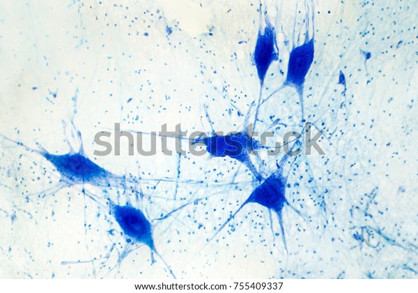 Light Micrograph Human Brain Tissue Showing Stock Photo (Edit Now ...