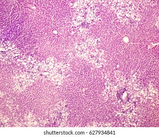 Light Micrograph Showing Case Fatty Liver Stock Photo (Edit Now) 627934841