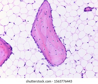 Light Microscope Micrograph Showing Bone Trabecula Stock Photo ...