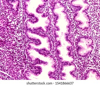 Light Microscope Micrograph Showing Endometrial Glands Stock Photo ...