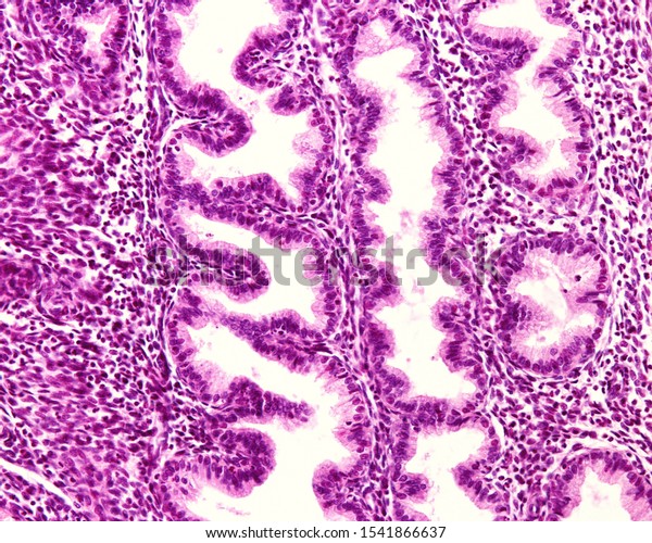 Light Microscope Micrograph Showing Endometrial Glands Stock Photo ...