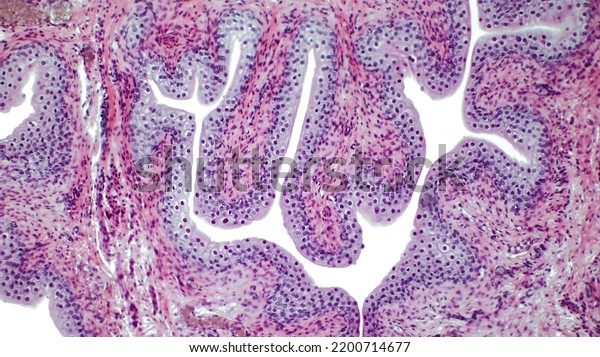 Light Microscopy Internal Lining Urinary Bladder Stock Photo 2200714677 ...