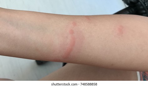Eczema Babies Itchy Rashes 스톡 사진 1440273980 | Shutterstock