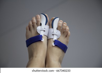 Lock Big Toe Values Deformation Stock Photo 667340233 | Shutterstock