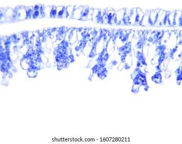 Longitudinal Section Hydra Under Microscope Hydra Stock Photo ...