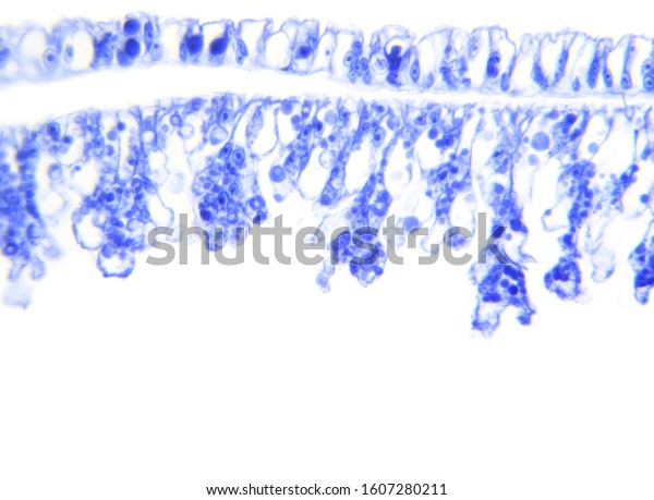 Longitudinal Section Hydra Under Microscope Hydra Stock Photo (Edit Now ...