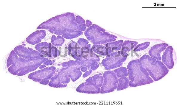 Low Power Light Microscope Micrograph Human Stock Photo 2211119651 ...