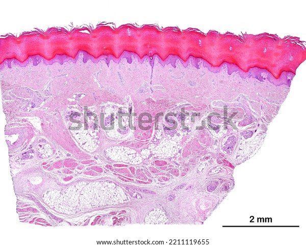 Low Power Light Microscope Micrograph Human Stock Photo 2211119655 ...